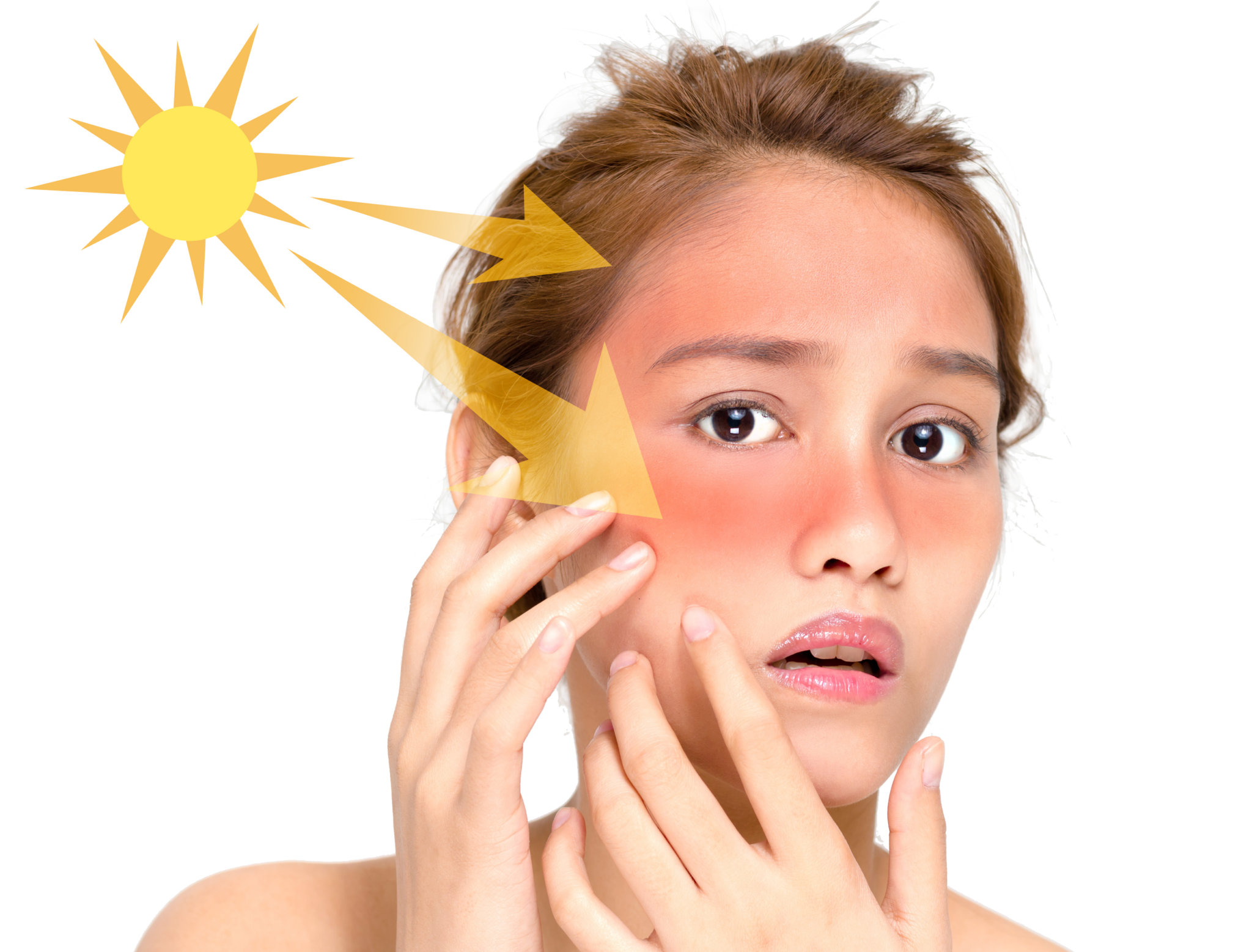The primary cause of premature ageing of the skin is the Sun